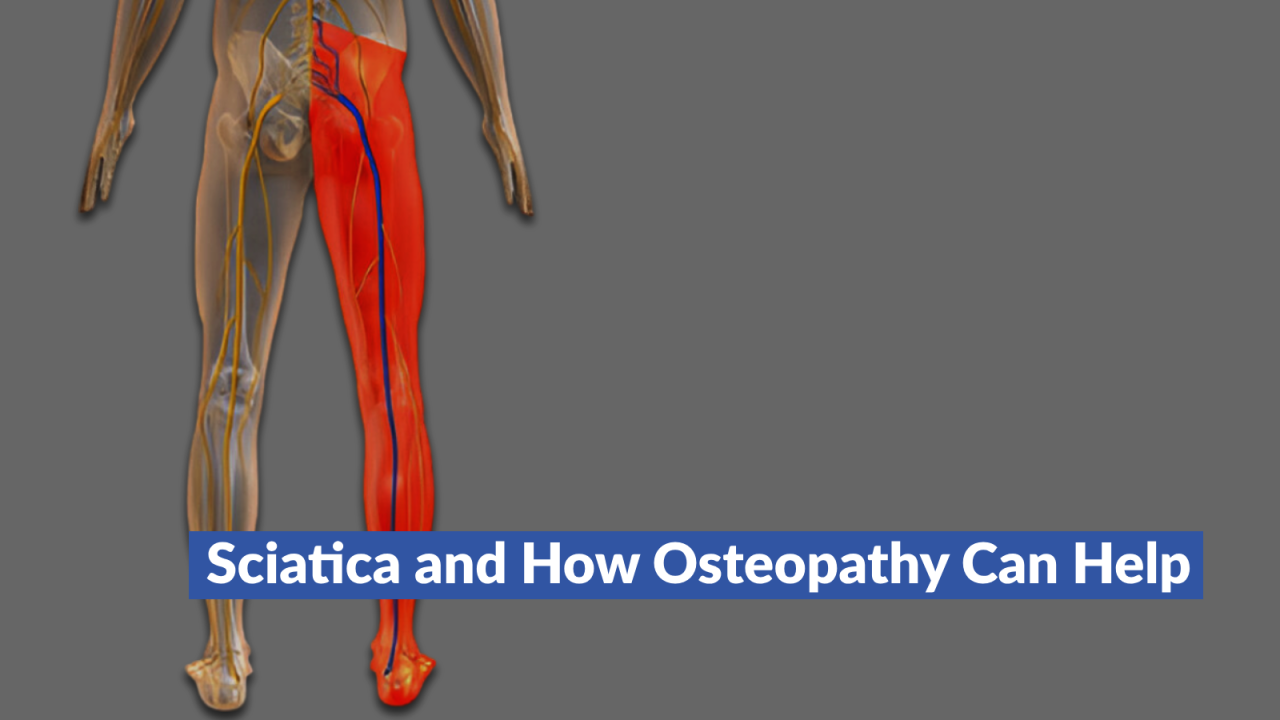 How Osteopathy Can Help | Osteopath for Sciatica Pain Relief